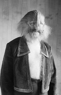 9 Rare Diseases Around the World - NSF News and Magazine