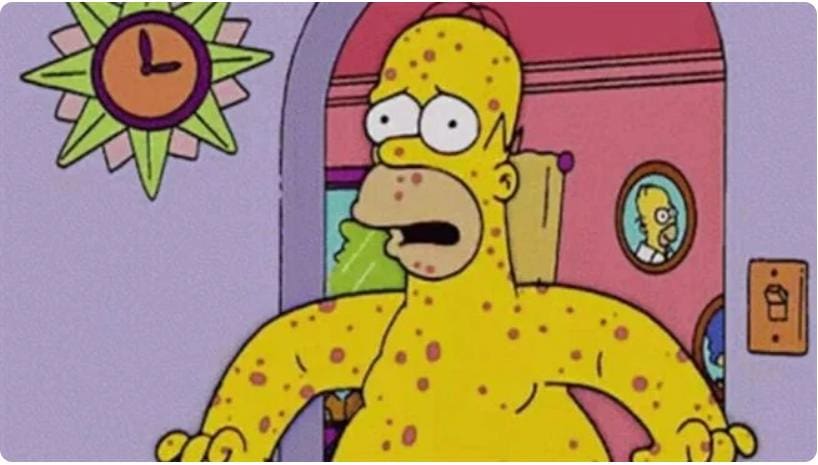 Did "The Simpsons" Predict the Monkeypox Virus? - NSF News & Tech