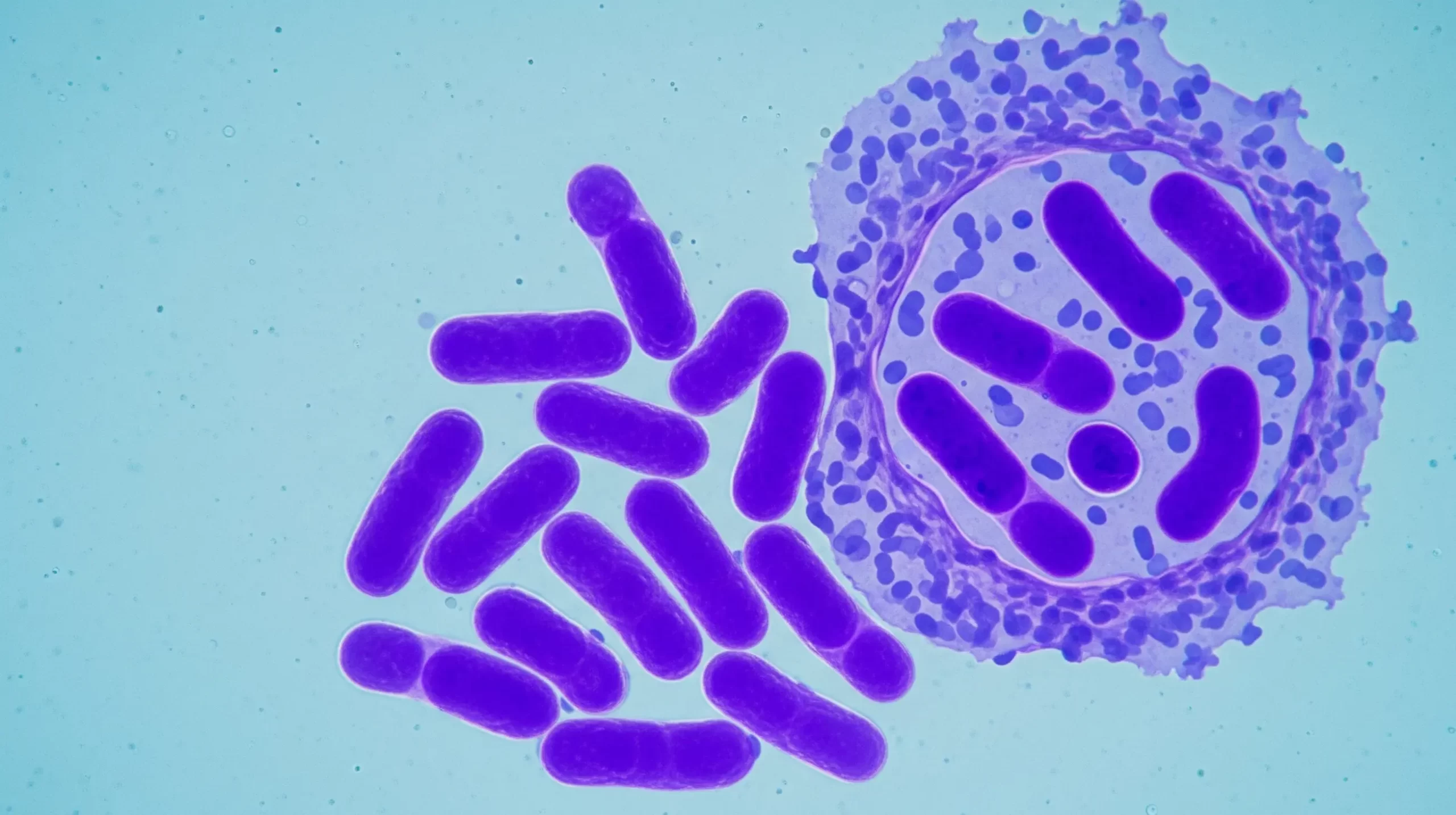 What Is Legionnaires' Disease? Causes, Symptoms, Prevention & Treatment ...